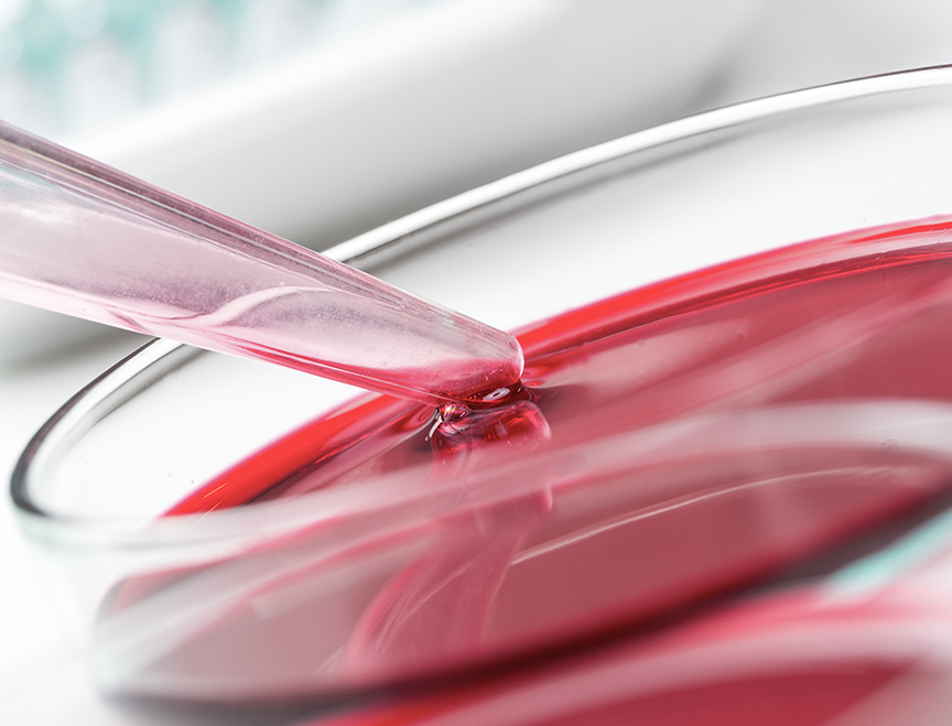 Lab, Infection Preventionists, and Blood Culture Contamination Goals